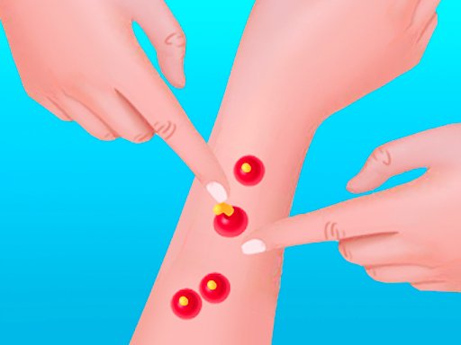 Pimple Poper Rush Game - Play Pimple Poper Rush Online for Free at ...