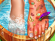 Feet Skin Doctor Game - Play Feet Skin Doctor Online for Free at YaksGames